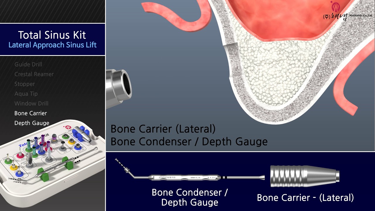 Total Sinus Kit - Haenaem Co., Ltd. - YouTube