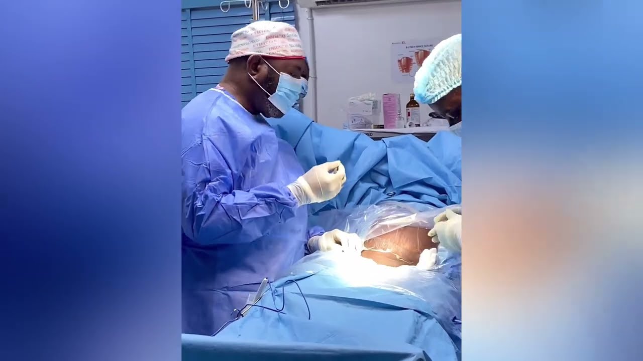 C- SECTION: GIVING BIRTH TO TWINS BY CAESAREAN SECTION - YouTube