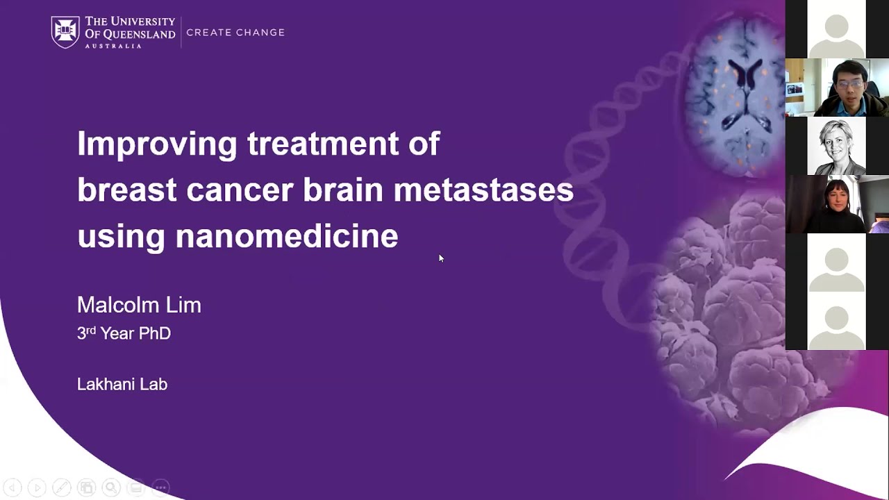 Improving treatment of breast cancer brain metastases using nanomedicine - Malcolm Lim - YouTube