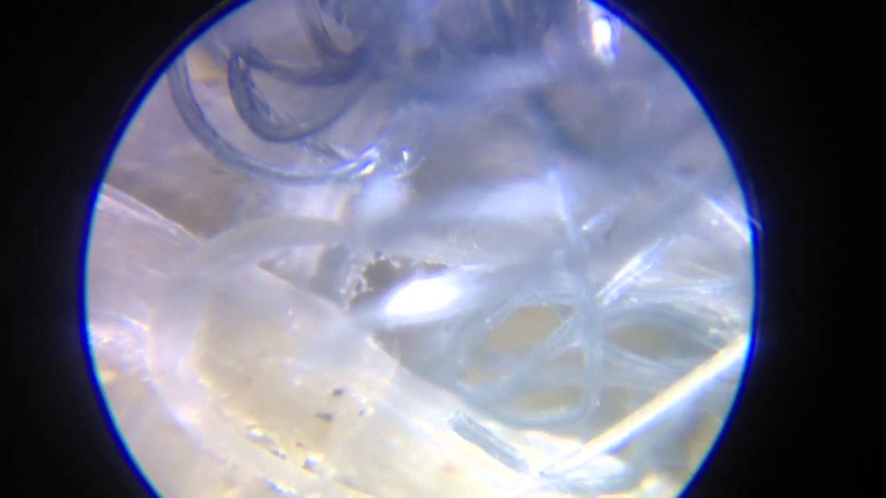 Clean Carpet Under 100X microscope - YouTube