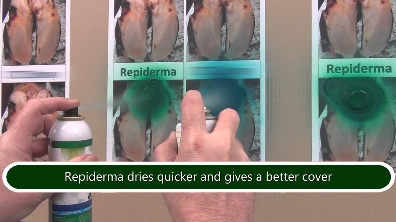 How to use Intra Repiderma - YouTube