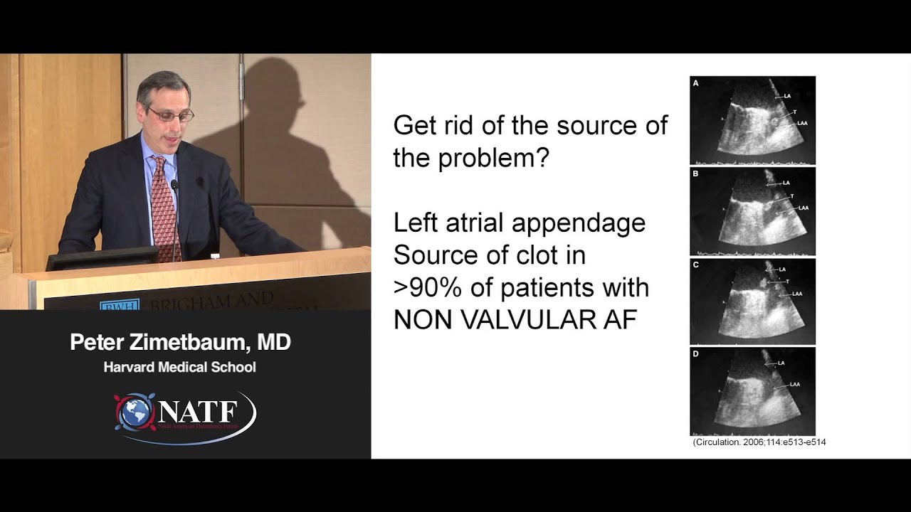 Electrophysiological Interventions for Atrial Fibrillation | Peter ...