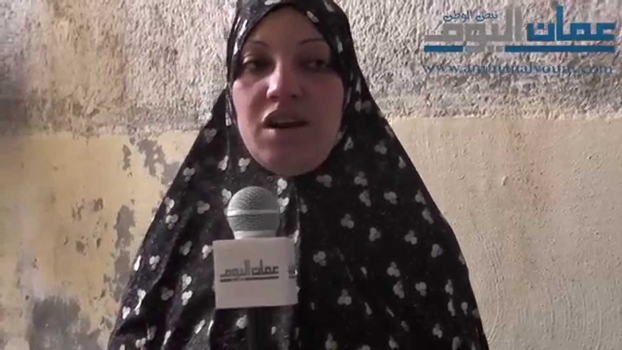 أخطر مرض بالعالم داء الفيل Youtube