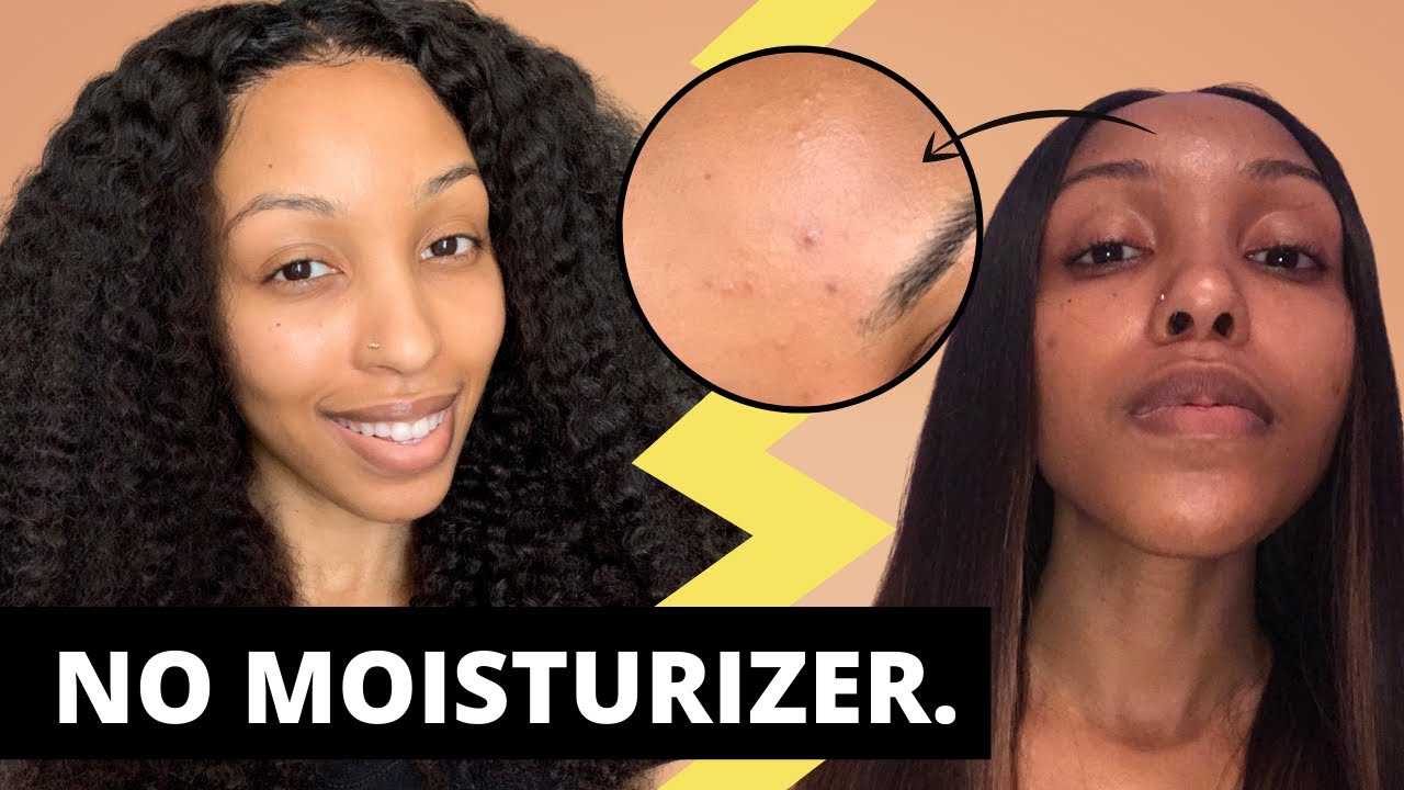 No Butters, No facial Oils, No Moisturizer for Clear Skin?? | Fungal ...