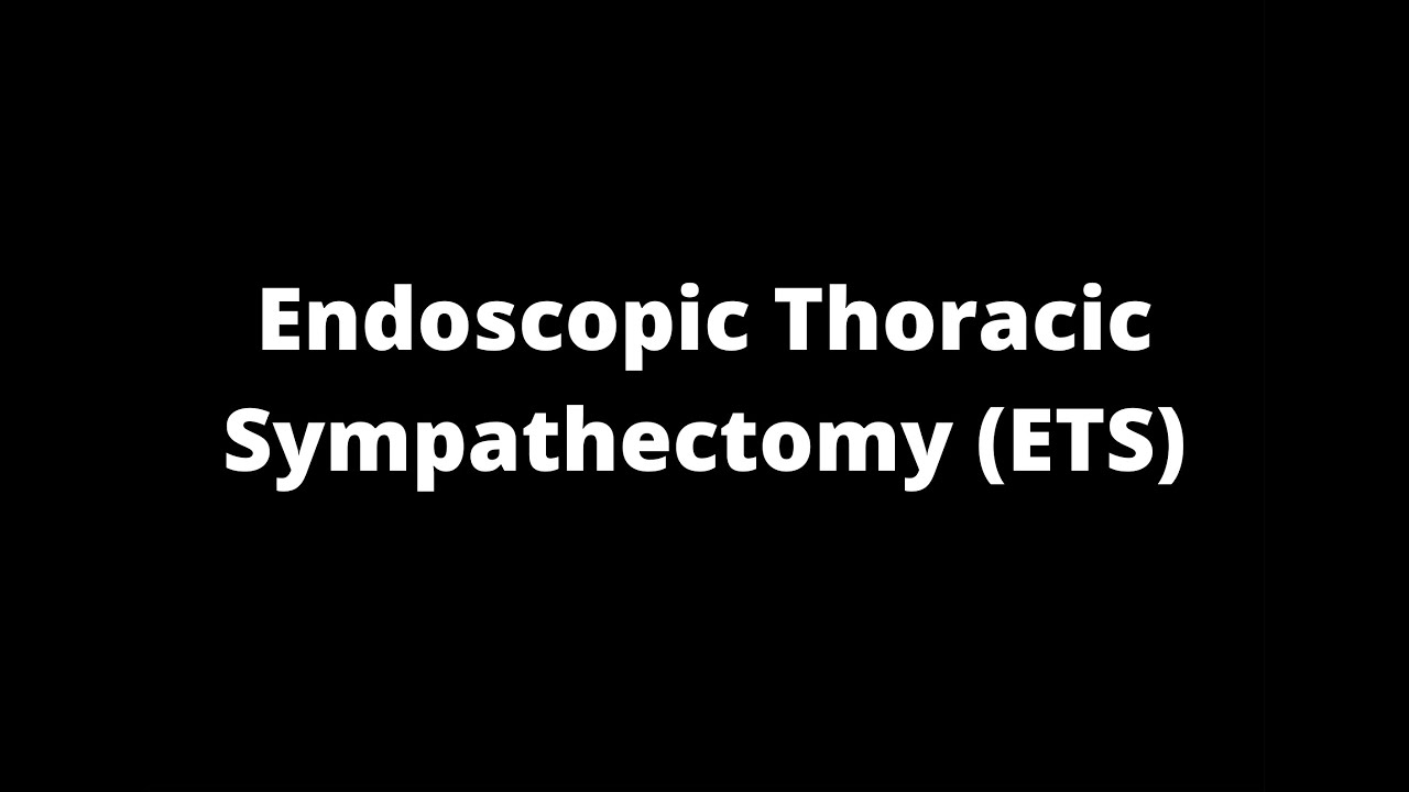 Endoscopic Thoracic Sympathectomy (ETS) - YouTube
