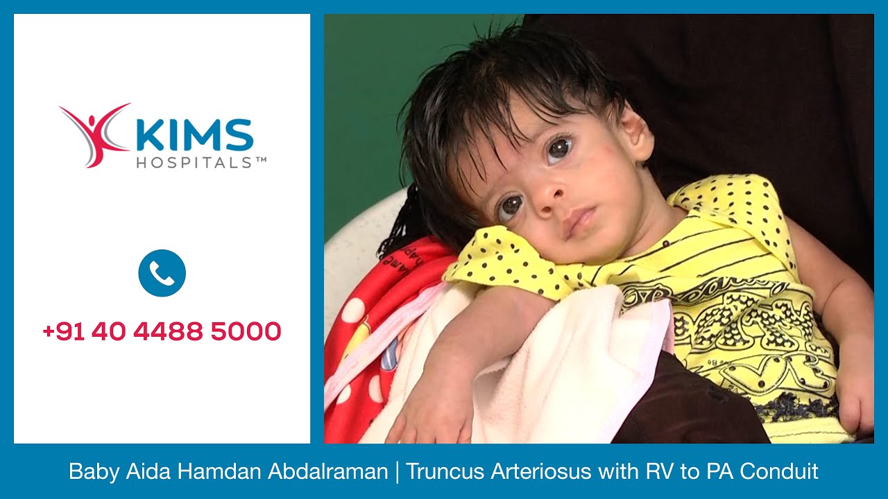 Baby Aida Hamdan Abdalraman | Truncus Arteriosus with RV to PA Conduit ...