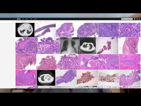 Creative Commons Pathology at 20 - YouTube