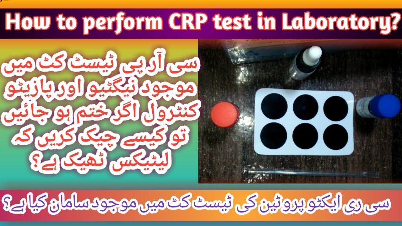how will you perform crp in laboratory|test|viral|qualitative|c ...