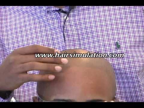 African American Hair loss- www.hairsimulation.com head tattoo -hair ...