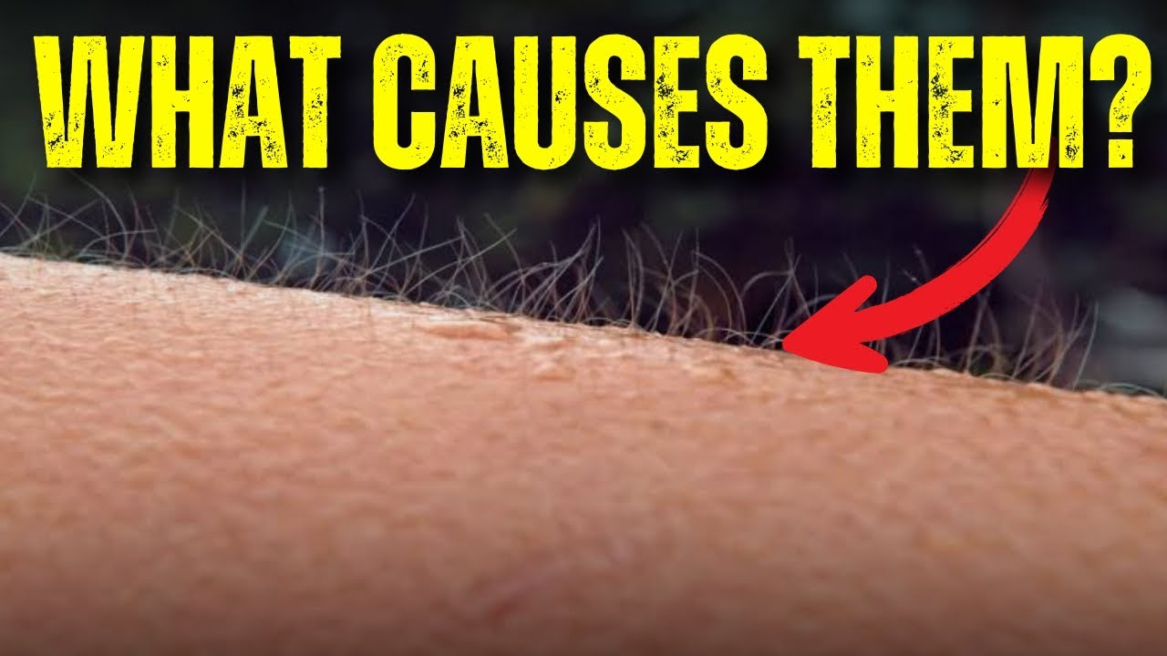 The Mystery of Why Humans Get Goosebumps - YouTube