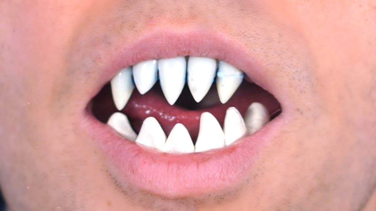 Humans With Shark Teeth