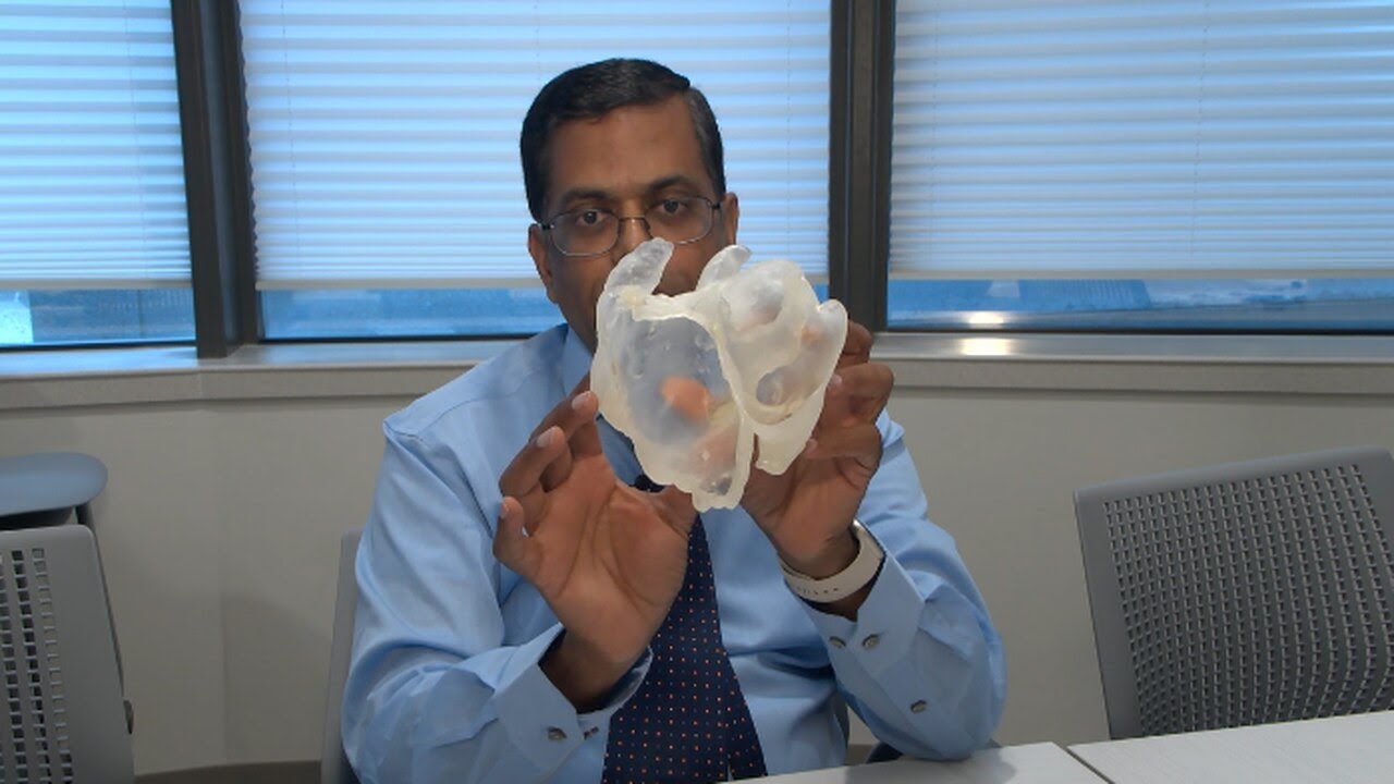 Univ. of Iowa Stead Family Children’s Hospital doctors repair heart ...