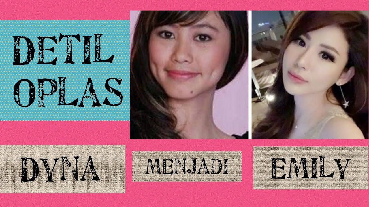 Membahas Dengan Lengkap Prosedur Oplas Apa Aja Yang Di Lakukan Oleh ...