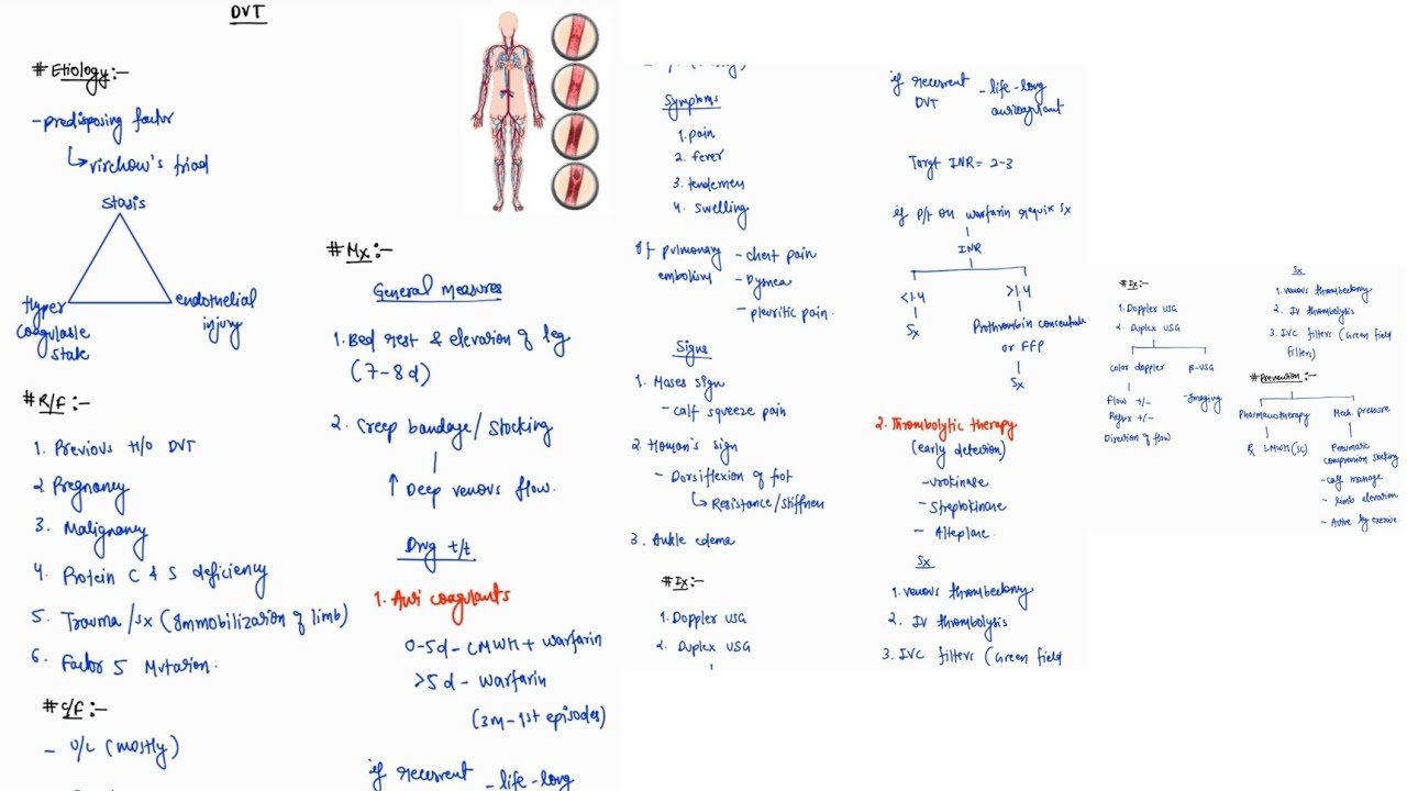 DEEP VEIN THROMBOSIS (DVT) NOTES | GENERAL SURGERY | ONE PAGE NOTES ...