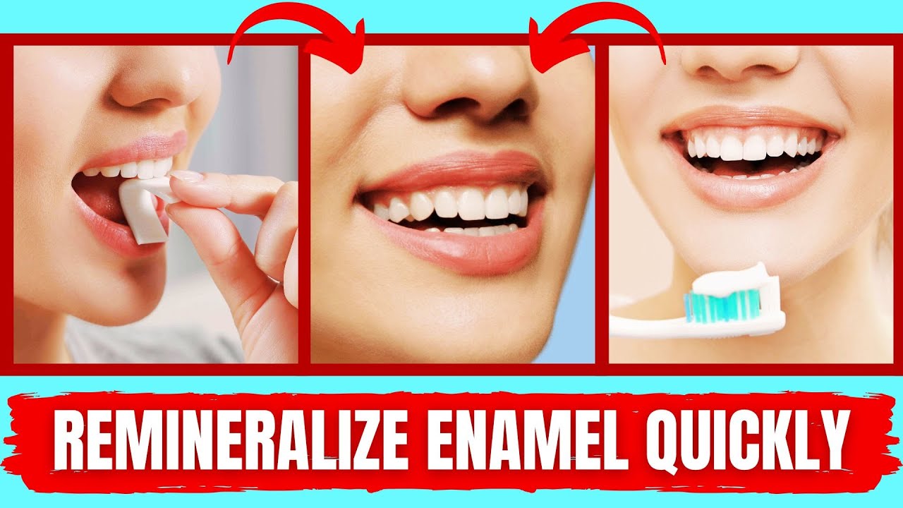 How to Remineralize Teeth Naturally 🦷 (Stop Cavities FAST!) - YouTube