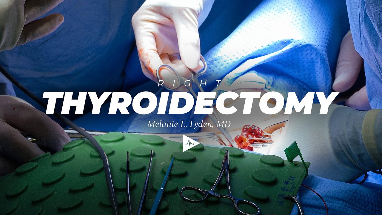 Right Thyroidectomy by Melanie L. Lyden, MD - YouTube