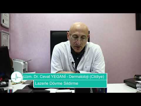 Lazerle Dövme Sildirme - Uzm. Dr. Cevat YEGANİ