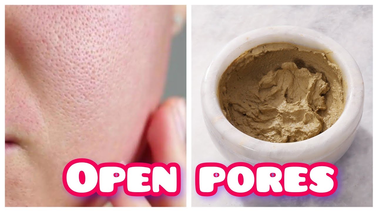 How to minimize Open Pores | Close Open pores home remedy | shrink open ...