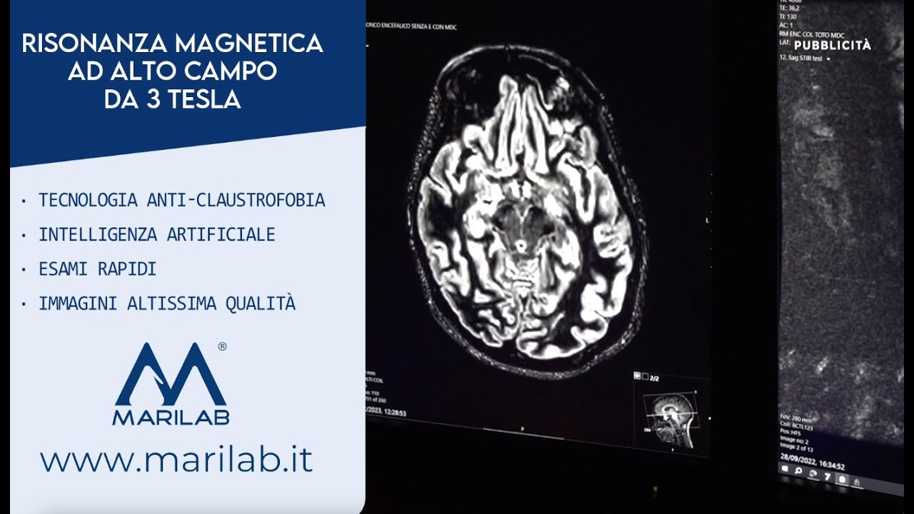 Risonanza magnetica ad alto campo da 3 Tesla al Marilab Center di Ostia ...