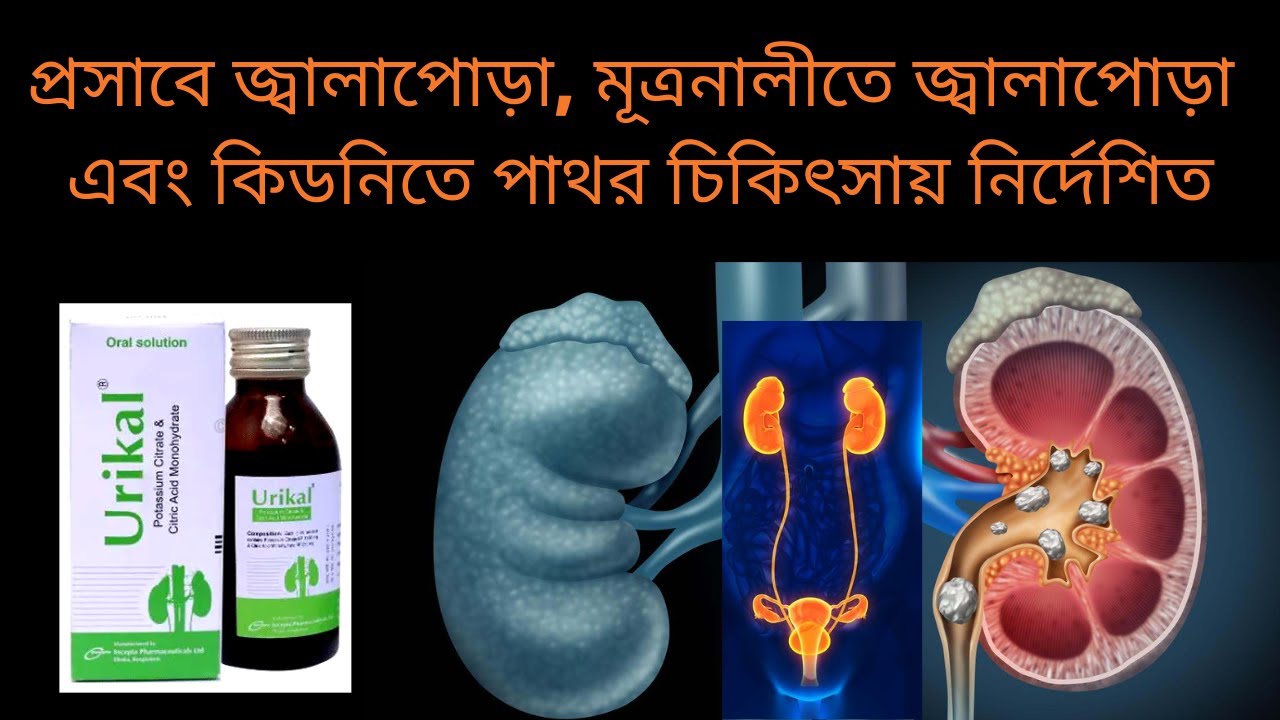 Urikal Syrup প্রসাবে জ্বালাপোড়া, মূত্রনালীতে জ্বালাপোড়া এবং কিডনিতে ...