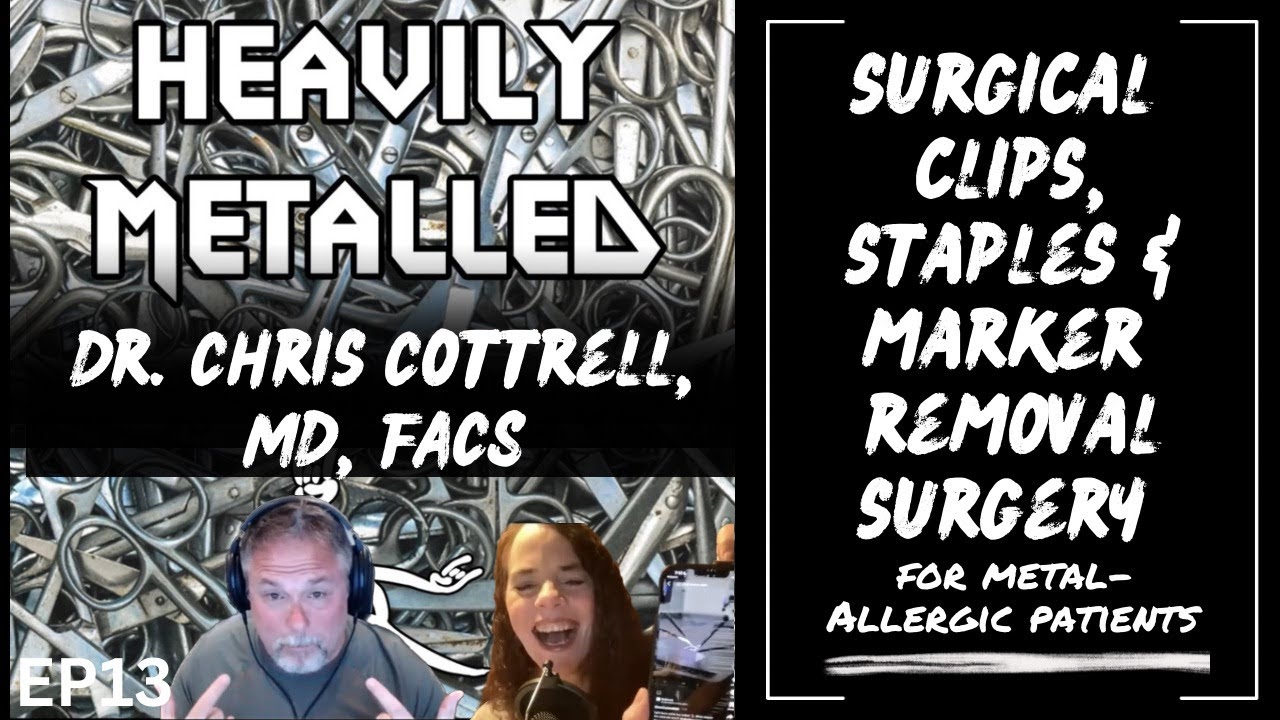EP13 - Surgical Clips, Staples & Marker Removal Surgery for Metal ...