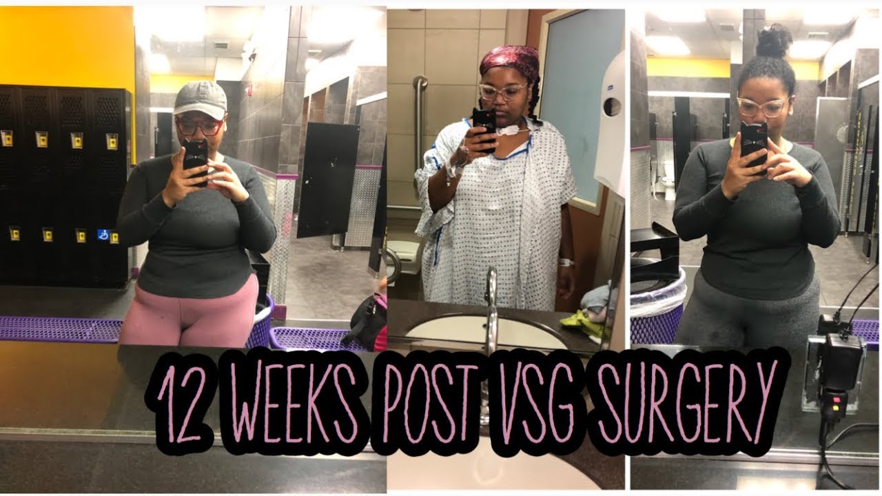WEEK 12 POST OP VSG SURGERY: Back To OLD Habits - YouTube