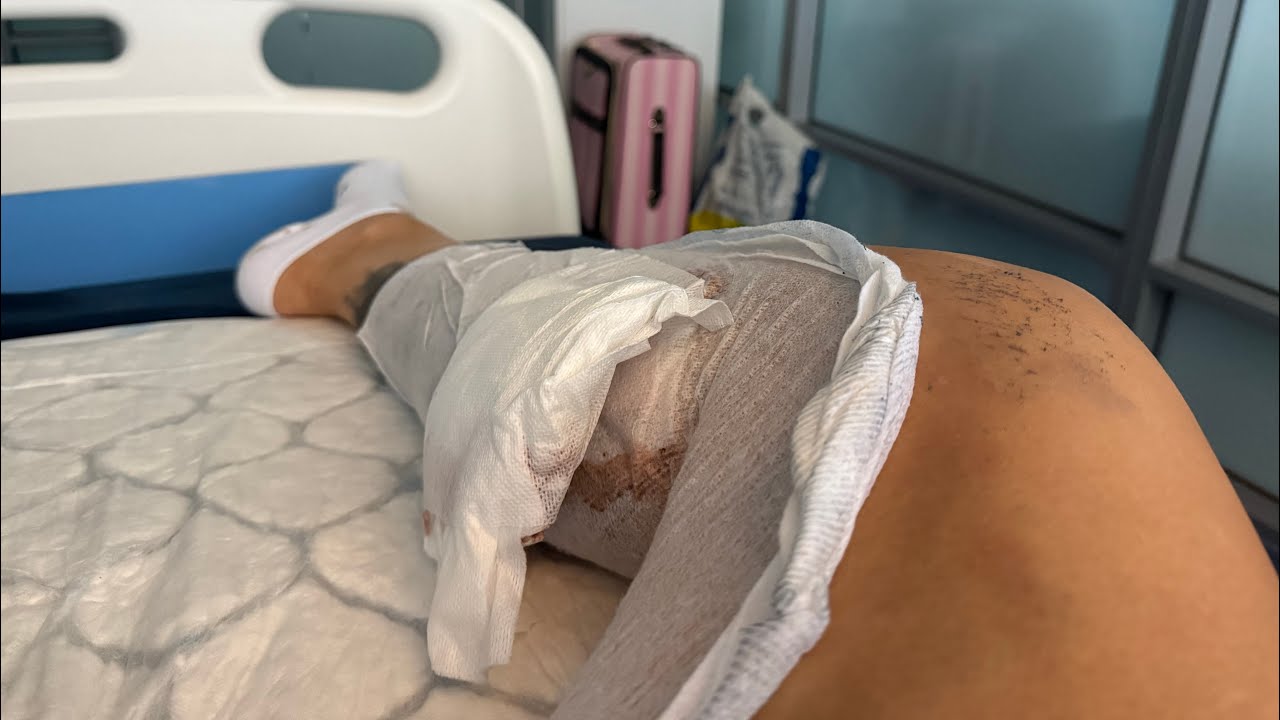 RASVAIMU LIHOTTAA!!🆘Tiesitkö nää asiat rasvaimusta? - YouTube