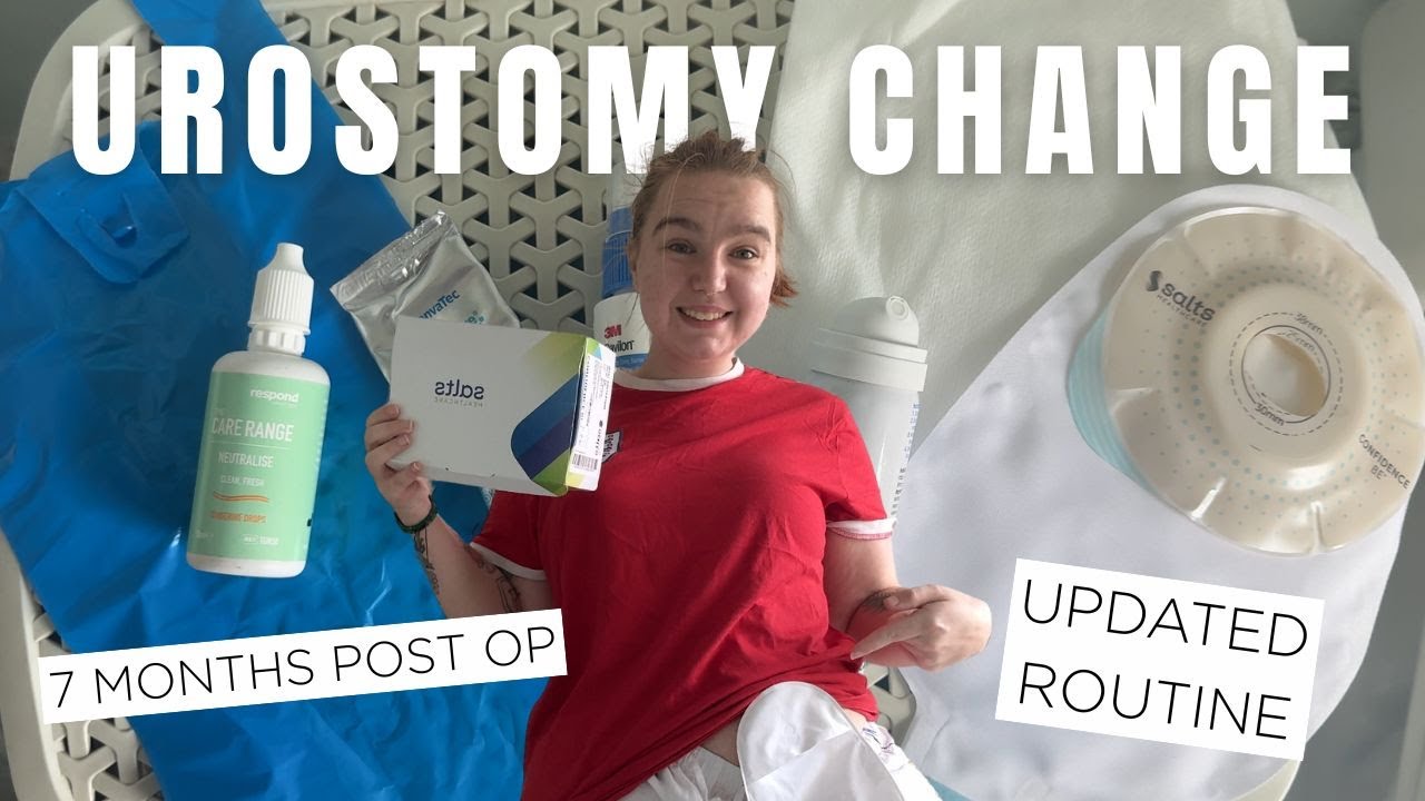 How I Change my Urostomy Bag | Updated Routine 7 Months Post Op - YouTube