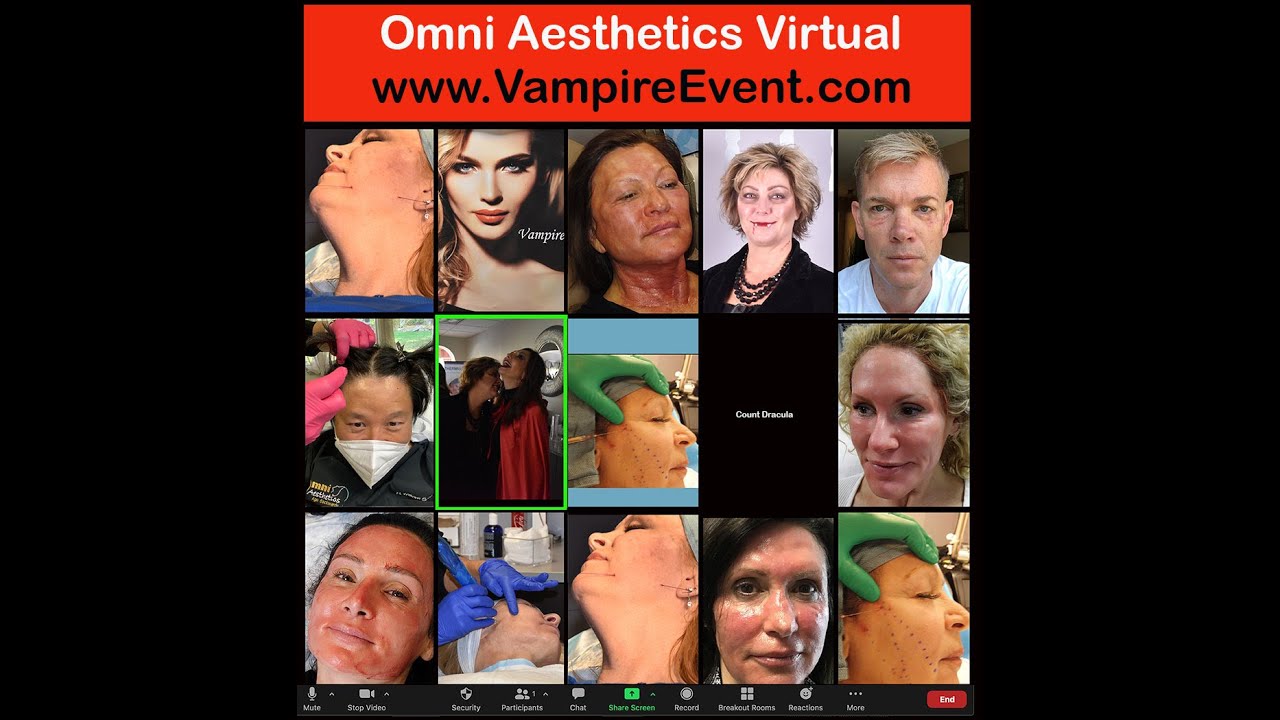 Omni Aesthetics Virtual Vampire Event 2020 - YouTube