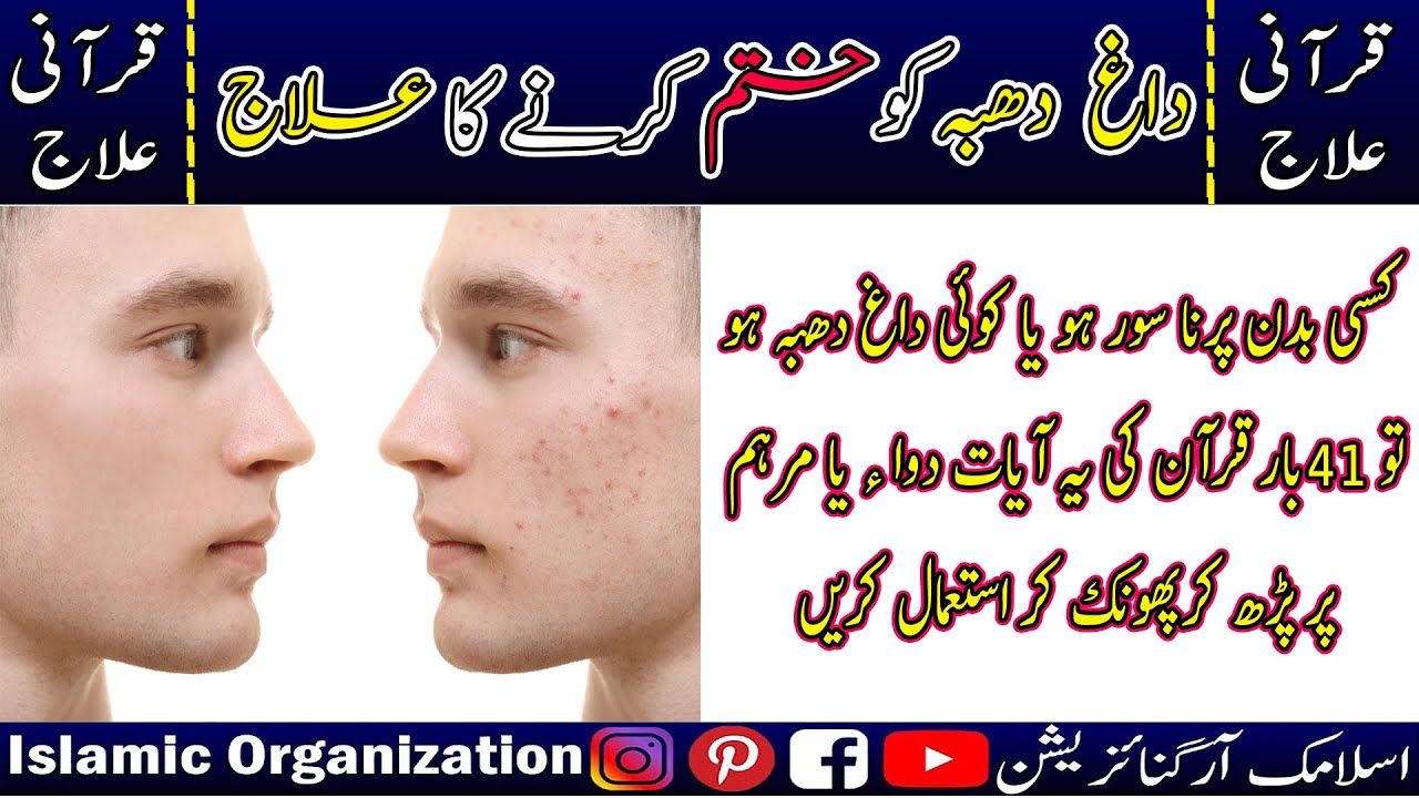Dagh Dhabe Door Karne ka Ilaj | Dagh | Dhabe | Islamic Organization ...