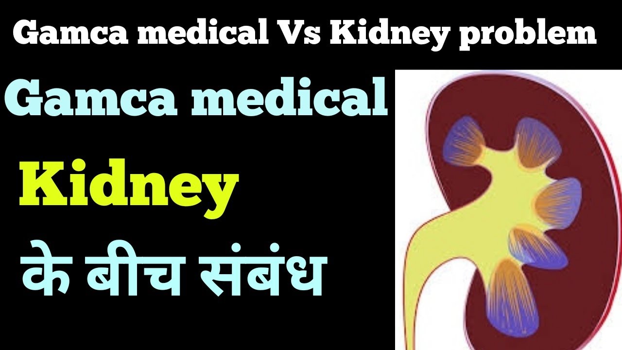 Kidney stones problem Vs Gamca medical checkup / के बीच संबंध - YouTube
