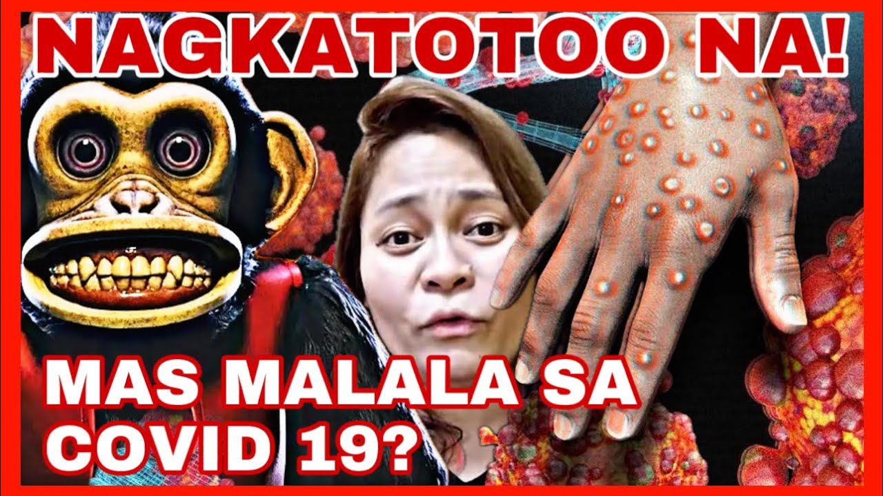 NAGKATOTOO NA! HULA NI RUDY BALDWIN, NANGYAYARI NA! GANITO PALA KATINDI ANG MONKEYPOX! - YouTube