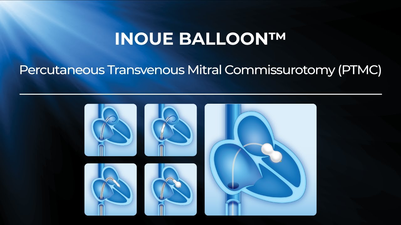 INOUE BALLOON CATHETER - FULL TUTORIAL - YouTube