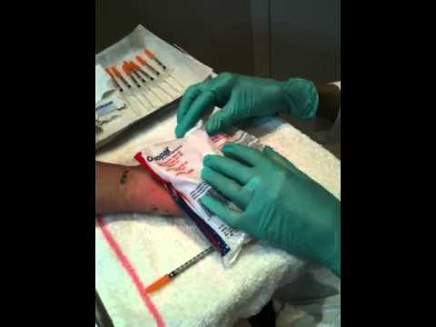 How does Botox for hyperhidrosis work? (treatment for exce - YouTube