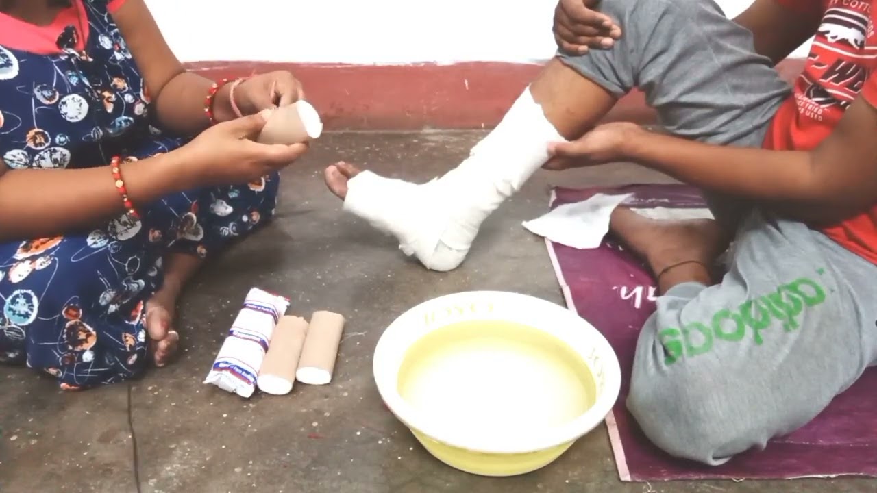 How to do plaster cast of foot at home | plaster cast kaise kare ...