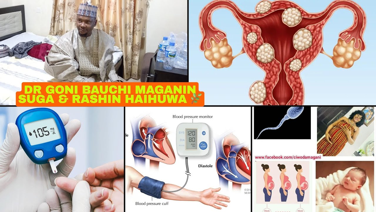 Maganin Ciwon Suga, Hawan Jini, Fibroid & Rashin Haihuwa daga Dr ...