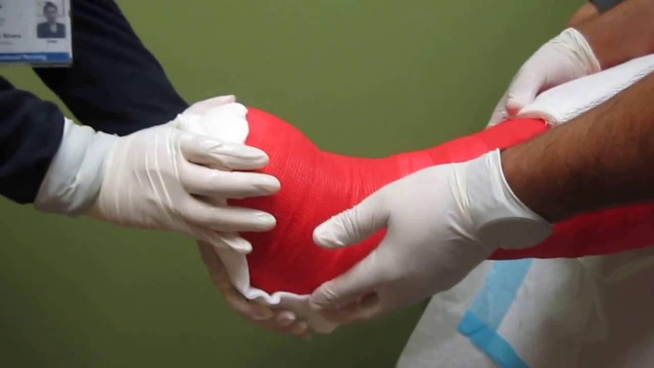 Instant total cast modified. 6/7 - YouTube