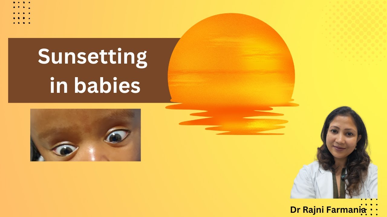 Ep. 38 Sun setting in babies I Setting sun sign I Dr Rajni Farmania ...