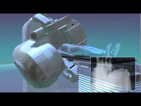 Varian Gated RapidArc - YouTube
