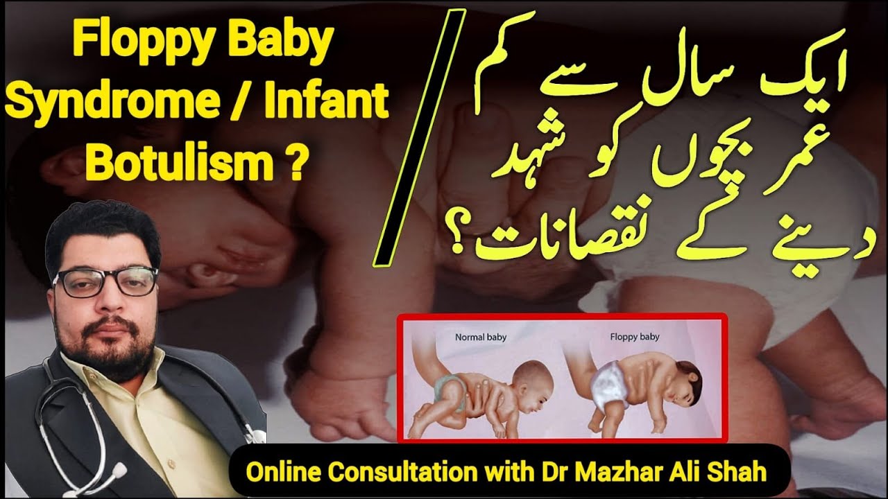 Infant Botulism symptoms|Floppy Baby syndrome |Online Consultation with ...