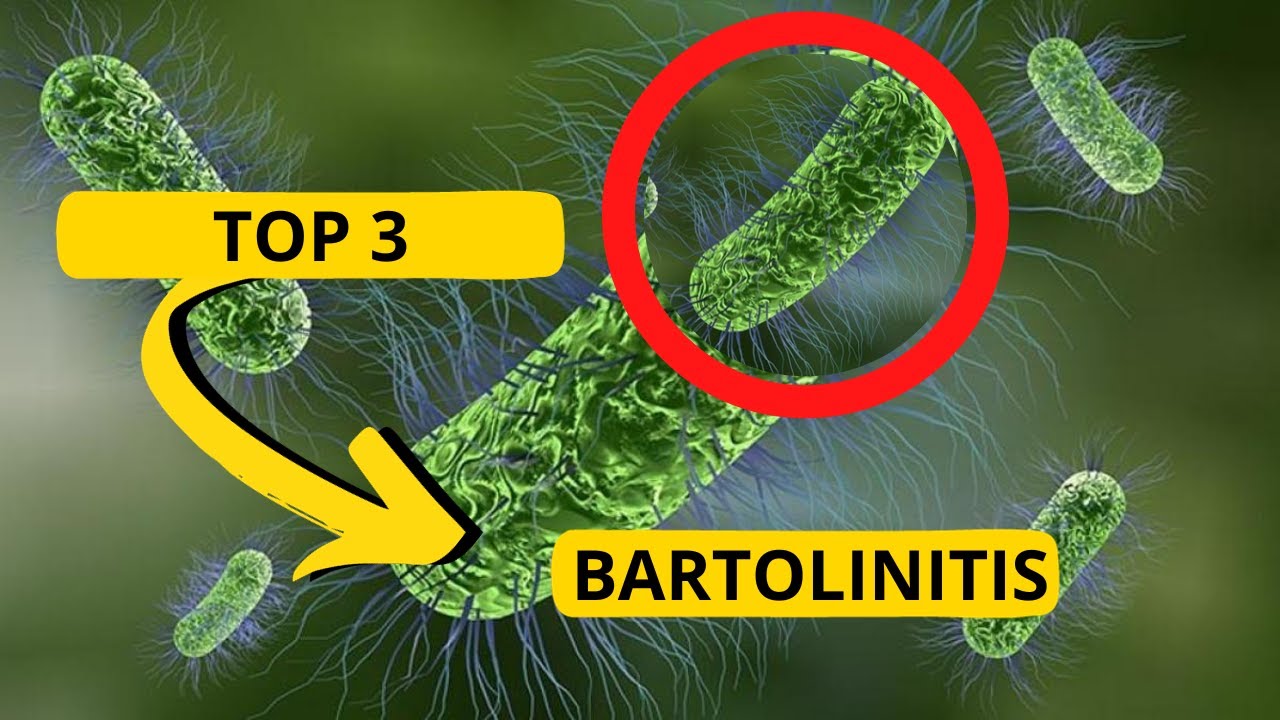 BARTOLINITIS | Infección Vaginal MEDICAMENTOS - YouTube