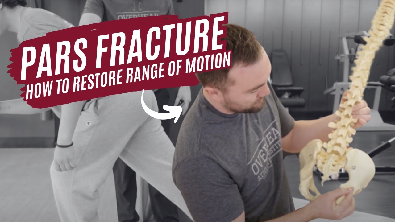 PARS Fracture - How To Restore Range of Motion - YouTube