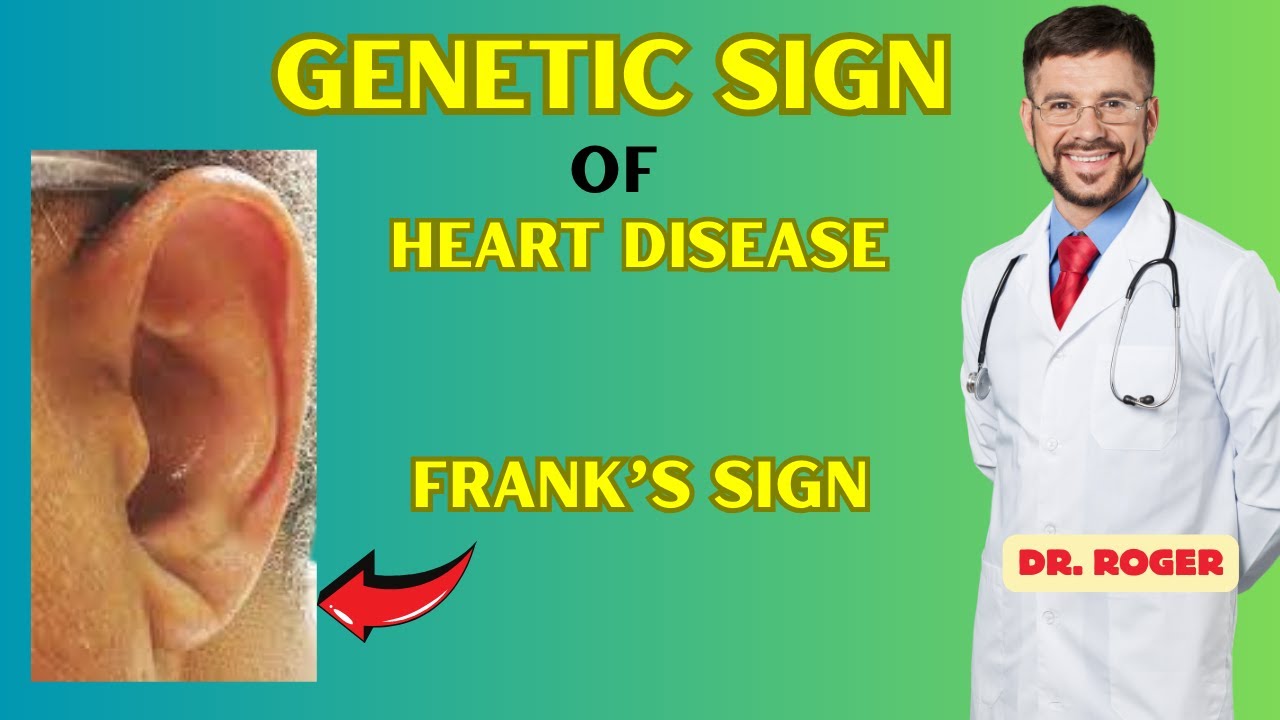 Earlobe Crease? Genetic Sign Of HEART DISEASE ️ This Could Save Your ...