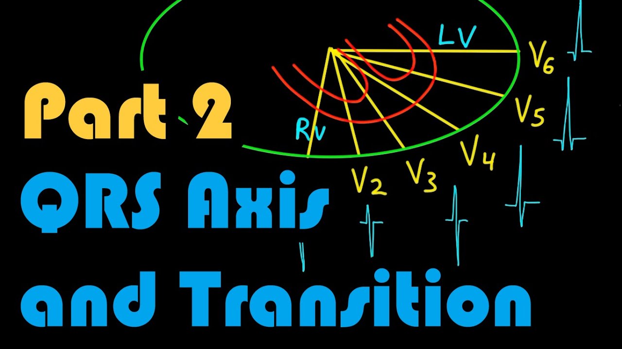 QRS Axis, QRS Transition, and R-Wave Progression, Part 2: How to Read ...
