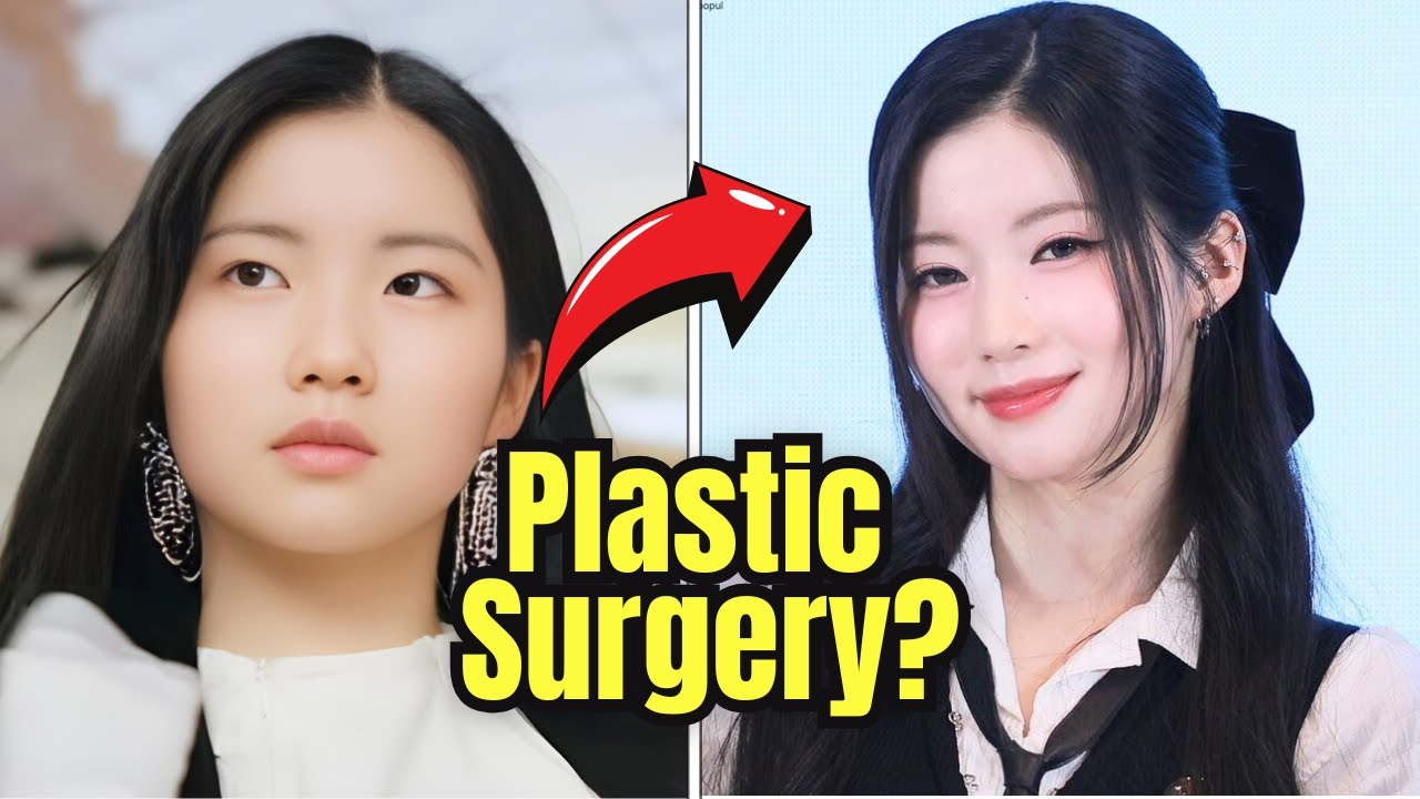 Plastic Surgery Accusations Against BABYMONSTER’s Asa Go Viral! - YouTube