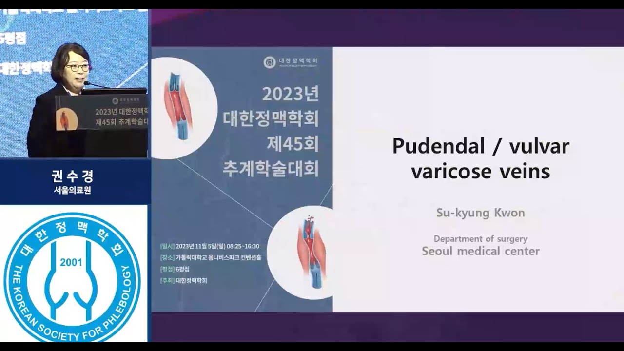 Pudendal / vulvar varicose veins - YouTube