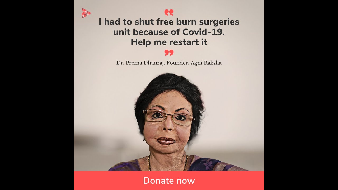Help Dr Prema of Agni Raksha provide free surgery & care for burn ...
