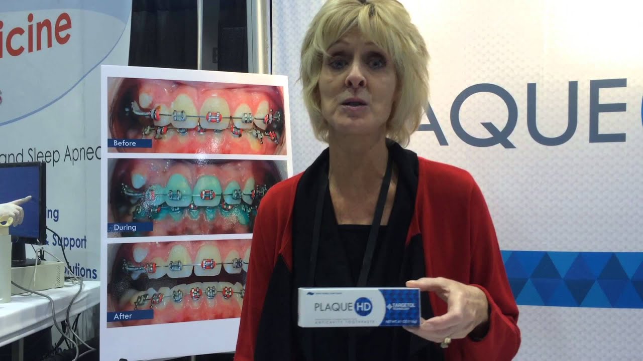 Plaque HD Product Demonstration - YouTube