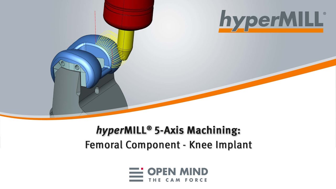 hyperMILL 5-Axis Machining: Femoral Component – Knee Implant | CAM ...