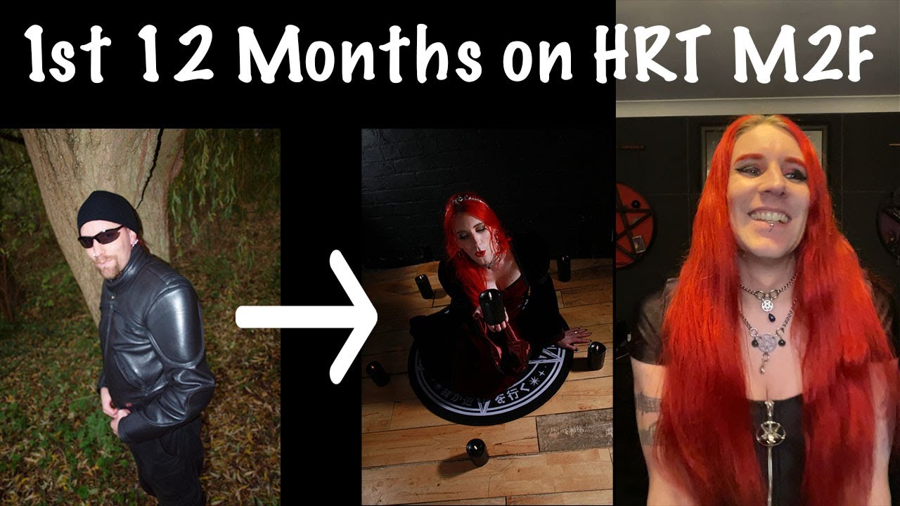 12 Months on HRT Transition M2F MTF, Bad Blood Test, Trans Partners ...